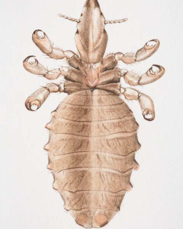 Traitement anti-poux avec Puressentiel - FemininBio